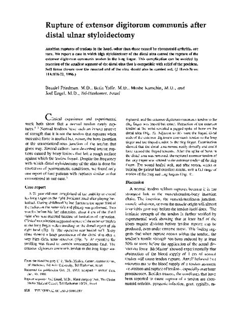 Pdf Rupture Of Extensor Digitorum Communis After Distal Ulnar Styloidectomy