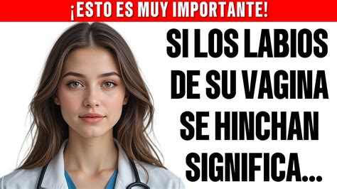 Que Pasa Si Sus Labios Vaginales Se Hinchan Urologa Responde Youtube