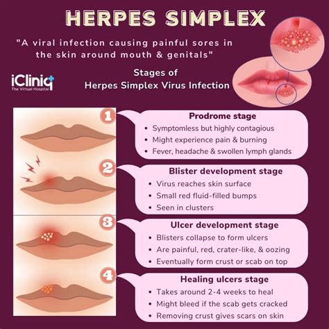 Oral Herpes Symptoms Pictures Causes Treatment 1296x728
