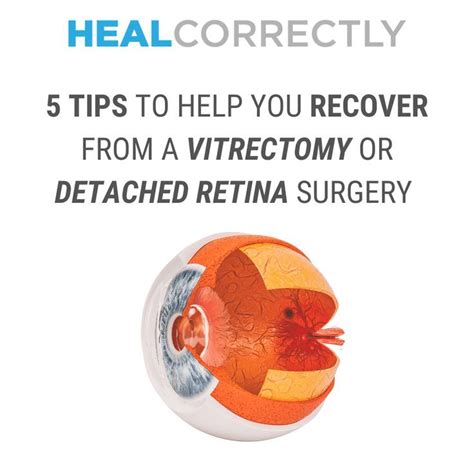 Vitrectomy In Patients With Uveitis