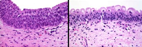 Path Of Urinary Bladder Flashcards Quizlet