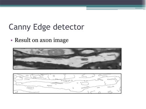 Ppt Edge Based Segmentation Powerpoint Presentation Free Download Id2042924