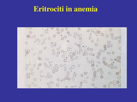 Ppt Eritrociti Powerpoint Presentation Free Download Id 4598242