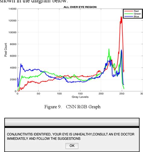 Figure 2 From Severity Based Detection Of Conjunctivitis And Drug