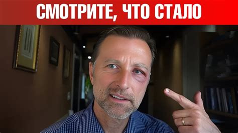 Вот до чего дошло 😲 Стресс кортизол преднизон Youtube