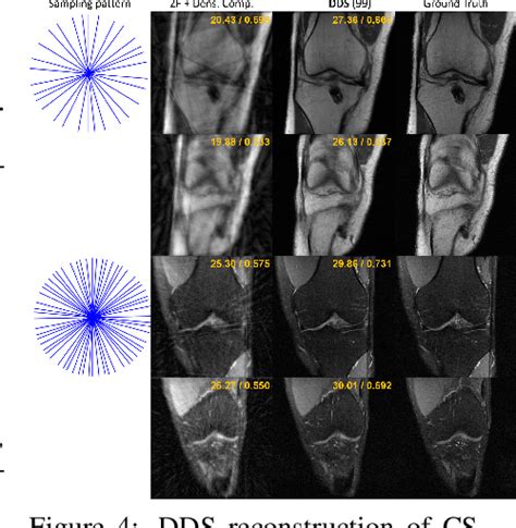 Figure 4 From Decomposed Diffusion Sampler For Accelerating Large Scale Inverse Problems