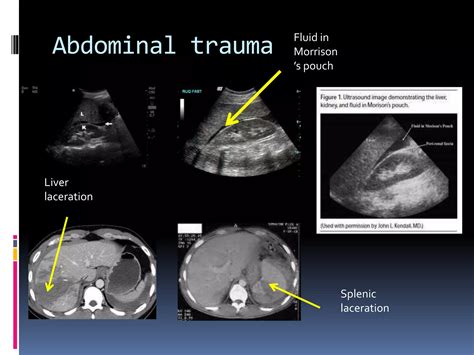 Interpret Axr And Imaging Of Gist System Ppt
