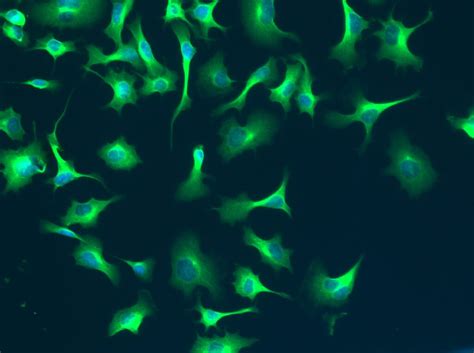 2d Automated Analysis Image Pro Media Cybernetics 2d Automated Analysis Image Pro Media Cybernetics