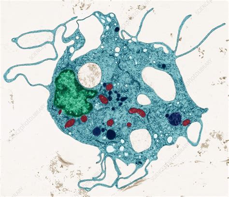 Fibroblast Tem Stock Image C026 0495 Science Photo Library