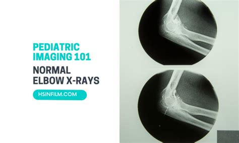 Medical X Ray Film Hsin Film
