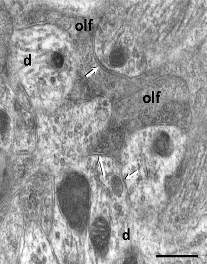 Neuronal Processes With Synaptic Vesicles In Mouse Olfactory Bulb P3 Download Scientific