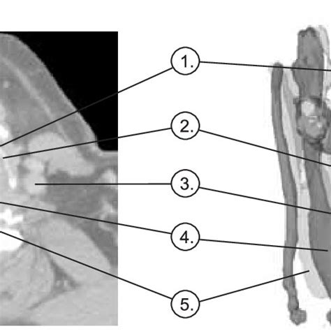 Segmentation Times Of The Particular Anatomical Structures In Minutes Download Table