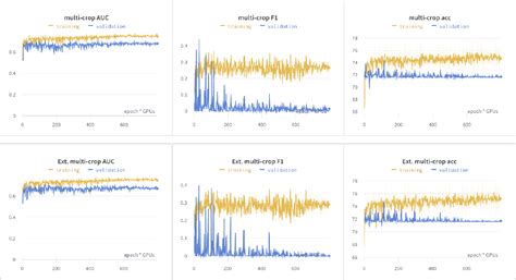 Figure 2 From Osteoporosis Prediction From Hand And Wrist X Rays Using Image Segmentation And