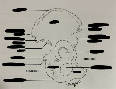 Coxal Or Pelvic Bone Lateral View Diagram Quizlet