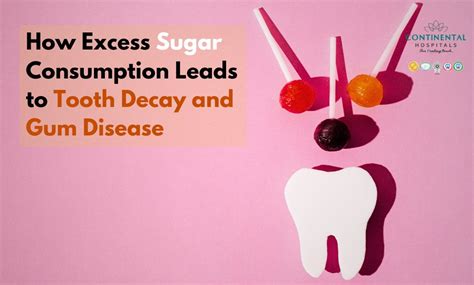 How Too Much Sugar Causes Tooth Decay And Gum Disease