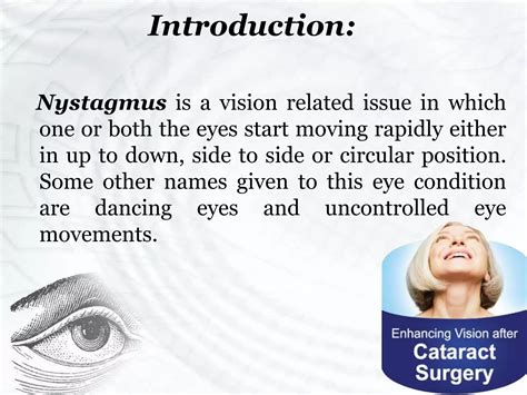 Nystagmus Symptoms Causes And Treatment Options Explained Pptx