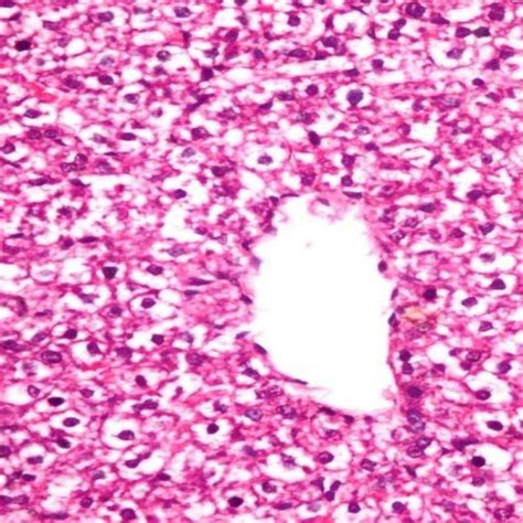 Section In Hepatic Tissue Treated With Cadmium Selenium After 6 Download Scientific Diagram