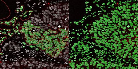 Halo Ai Trainable Ai For Pathology Indica Labs