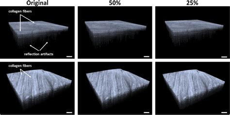 3 D Compressed Sensing Optical Coherence Tomography Using Predictive