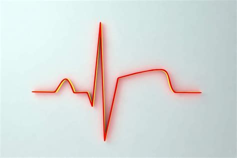 GitHub NicolasDMun Myocardial Infarction Clinical Machine Learning These Are Some Of The