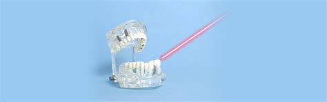 Benefits Of Using A Laser For A Frenectomy