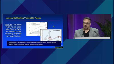 Current Medical Therapy Is The Gold Standard For Plaque Stabilization