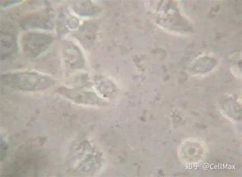 细胞培养中出现的小黑点到底是什么那？ 知乎