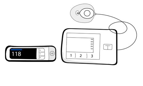 Meter And Medtronic Pump Vs Meter And Tandem Vs Eversense And Afrezza