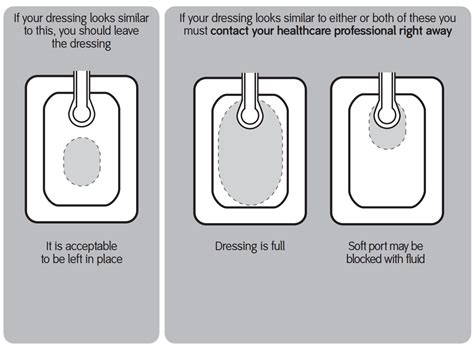 Smith Nephew PICO 14 Single Use Negative Pressure Wound Therapy System User Manual