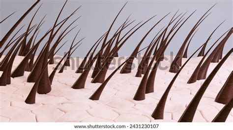 Get Rid Peel Over Royalty Free Licensable Stock Illustrations Drawings Shutterstock
