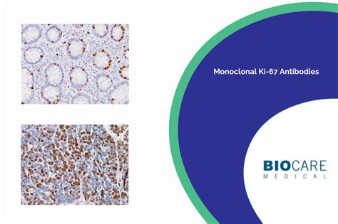Product Focus Monoclonal Ki 67 Antibodies Medical Supply Company Ltd