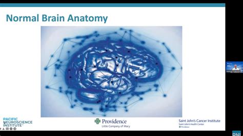 Brain Tumor Symptoms And Treatment Options