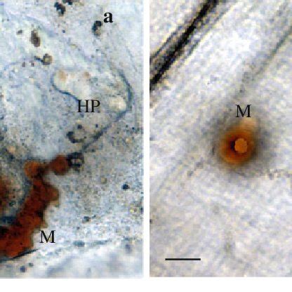 Montage Of Photomicrographs 1009 Of Spore Cyst Attached To The Download Scientific Diagram
