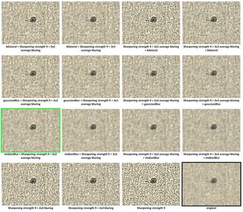 Design And Implementation Of Defect Detection System Based On Yolov5