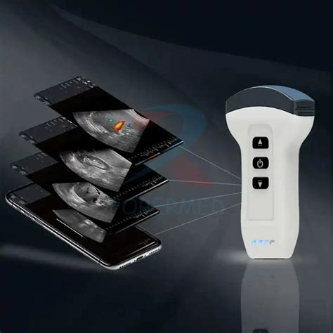 Usb Convex Wireless Ultrasound Scanner Wifi Usg Ultrasound Probe Wireless Ultrasound And
