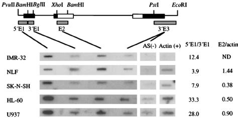 Transcriptional Attenuation In N Myc Exon 1 Occurs In Both