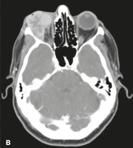 Tc De Órbita • Amd Saúde
