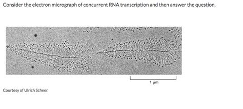 Solved Consider The Electron Micrograph Of Concurrent Rna