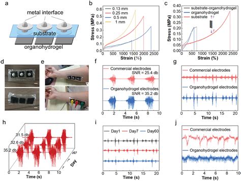 organohydrogel‐based soft semg electrodes for algorithm‐assisted