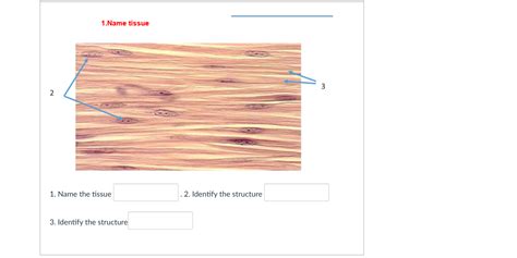 Solved Name The Tissue Identify The Structure Chegg