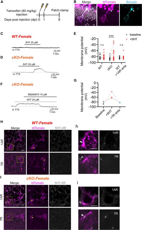 Sex Specific Expression Of Distinct Serotonin Receptors Mediates Stress