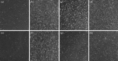 Microphotographs Of Viral Induced Cytopathic Effects In Download