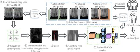 Figure 2 From Automated Dental Image Analysis By Deep Learning On Small