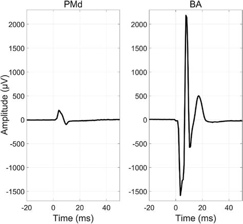 muscle artifacts waveforms after stimulating the dorsal premotor