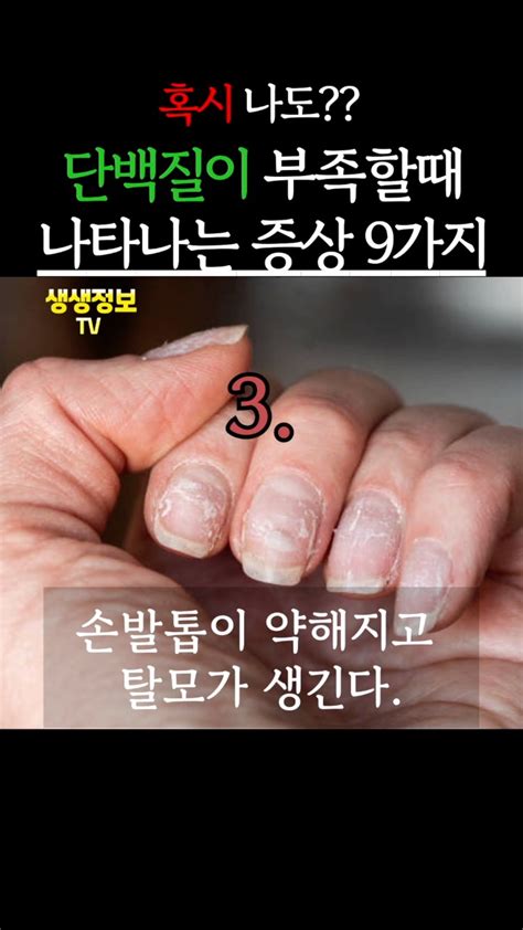단백질이 부족할 때 나타나는 증상 9가지 단백질 다음 루프