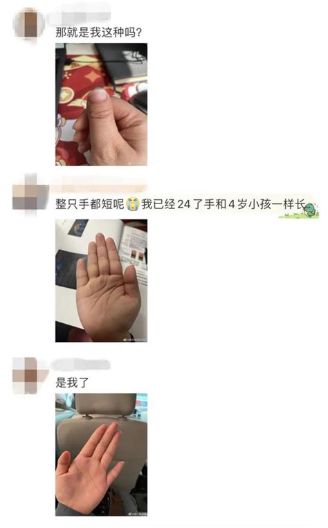 手指又短又粗，到底是不是一种病？医生提醒… 知乎