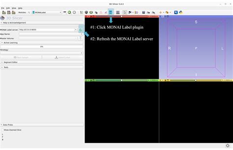 Quickstart — Monai Label 070rc7 Documentation