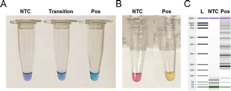 Rapid Sperm Lysis And Novel Screening Approach For Human Male Dna Via Colorimetric Loop Mediated