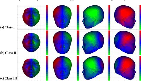 Figure 1 From Occlusion Based Three Dimensional Craniofacial Anthropometric And Symmetric