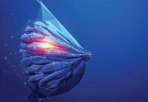 Osama Ammar Msc On Linkedin Artificial Intelligence In Breast Imaging